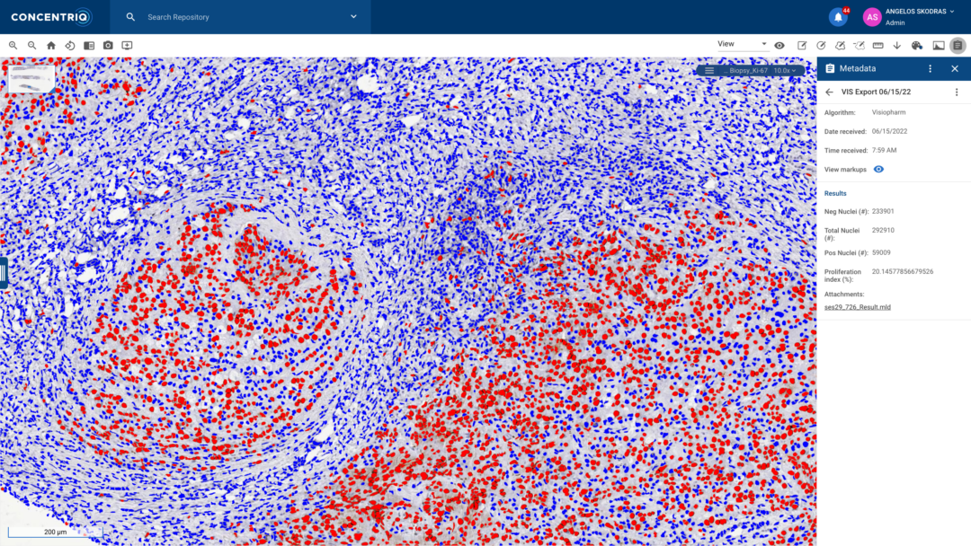 5 Reasons Why CROs Choose Concentriq - Proscia